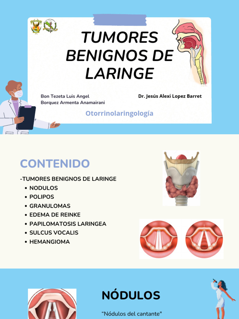 Presentación Tumores Benignos Laringe | PDF | Neoplasias | Medicina CLINICA