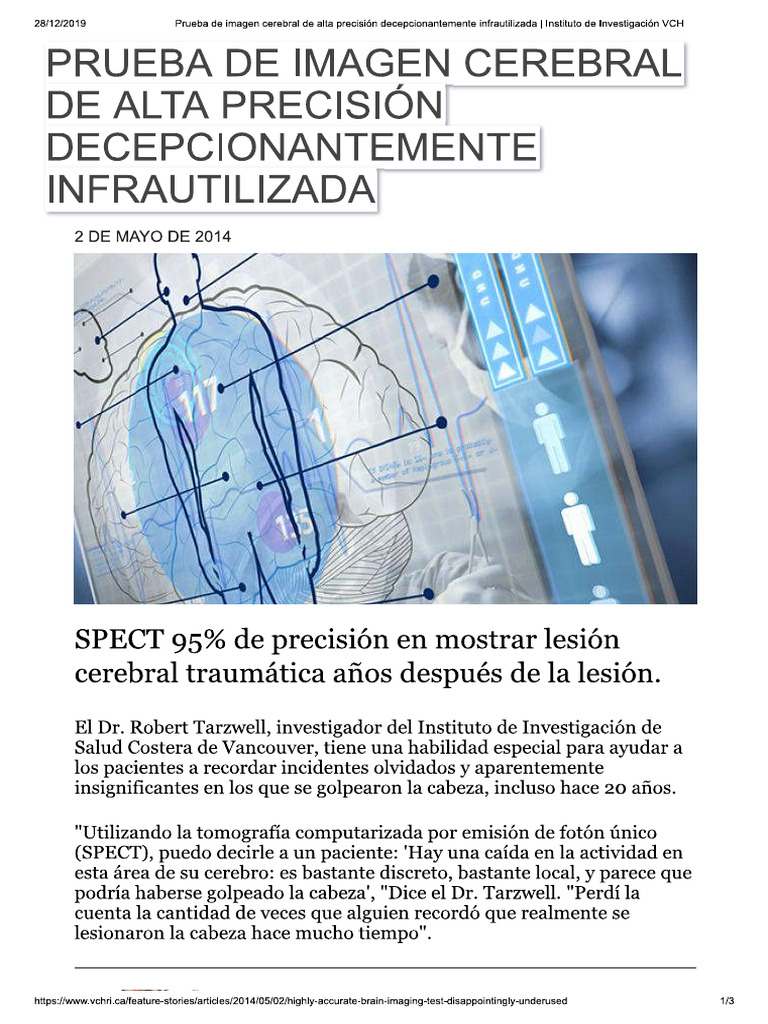 SPECT Prueba de Imagen Cerebral INFRAUTILIZADA | PDF