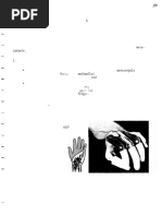 Short Opponens Spilint | PDF | Hand | Thumb