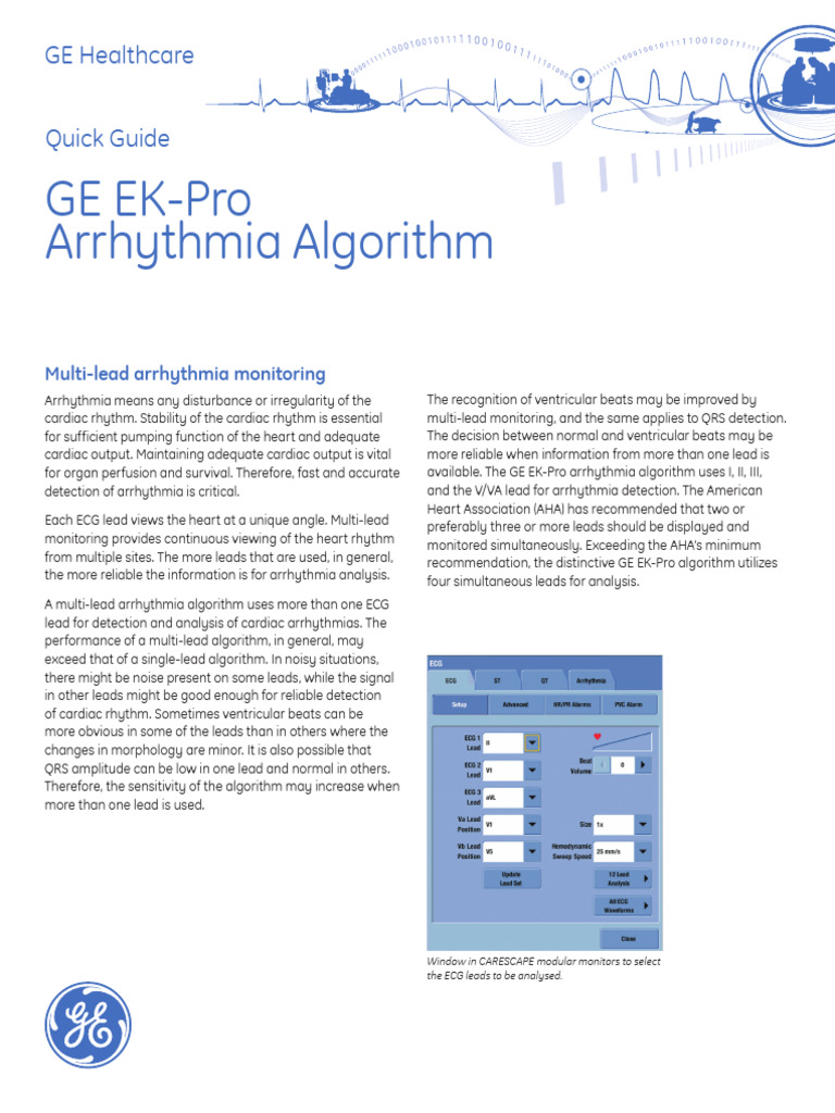 GE Healthcare GE EK-Pro Arrhythmia Algorithm Brochure | PDF ...