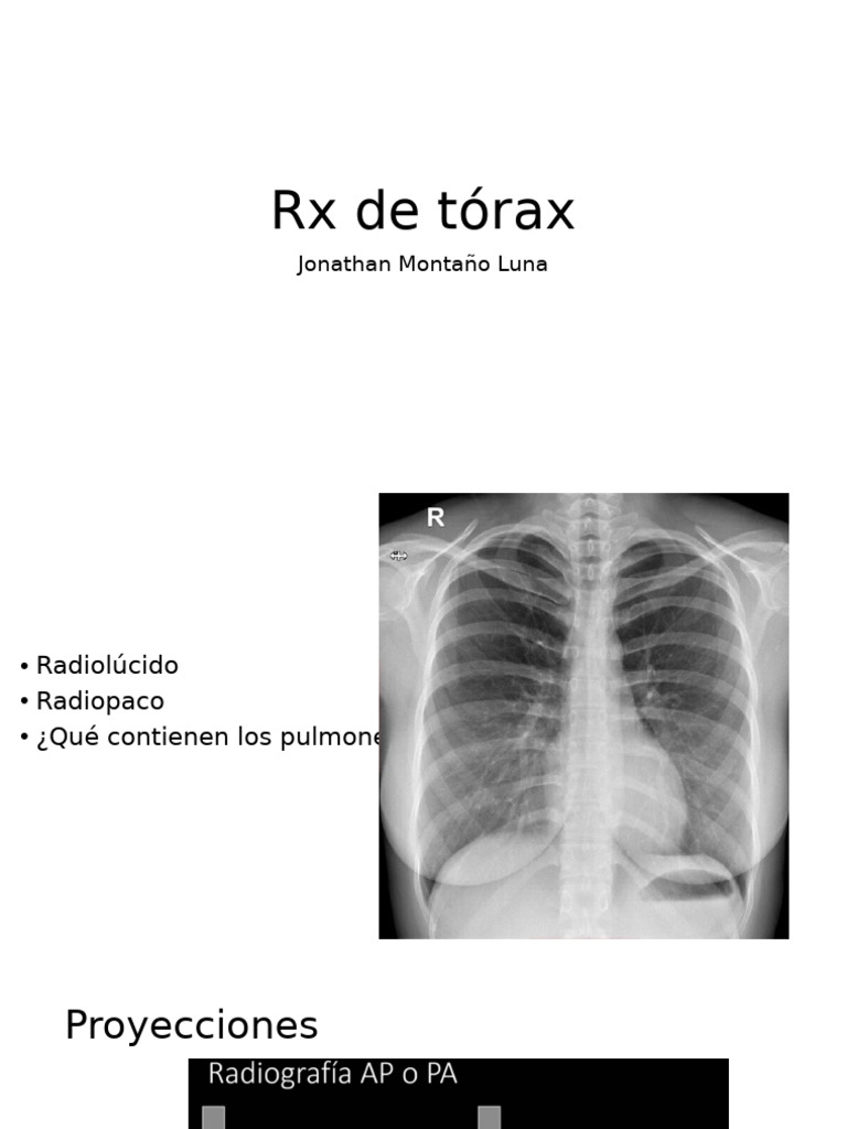 Lectura de RX de Torax | PDF
