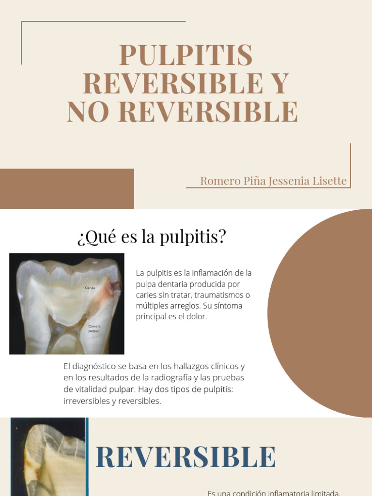 Pulpitis y Necrosis | PDF | Enfermedades y trastornos | Especialidades Medicas