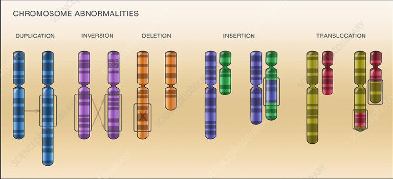 C0306636-Chromosome Abnormalities, Illustration | PDF