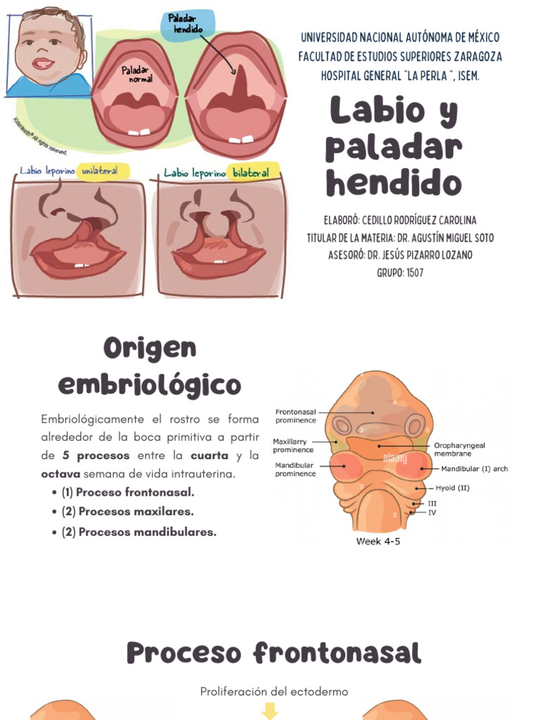 Labio y Paladar Hendido: Causas y Tratamiento | PDF | Especialidades ...