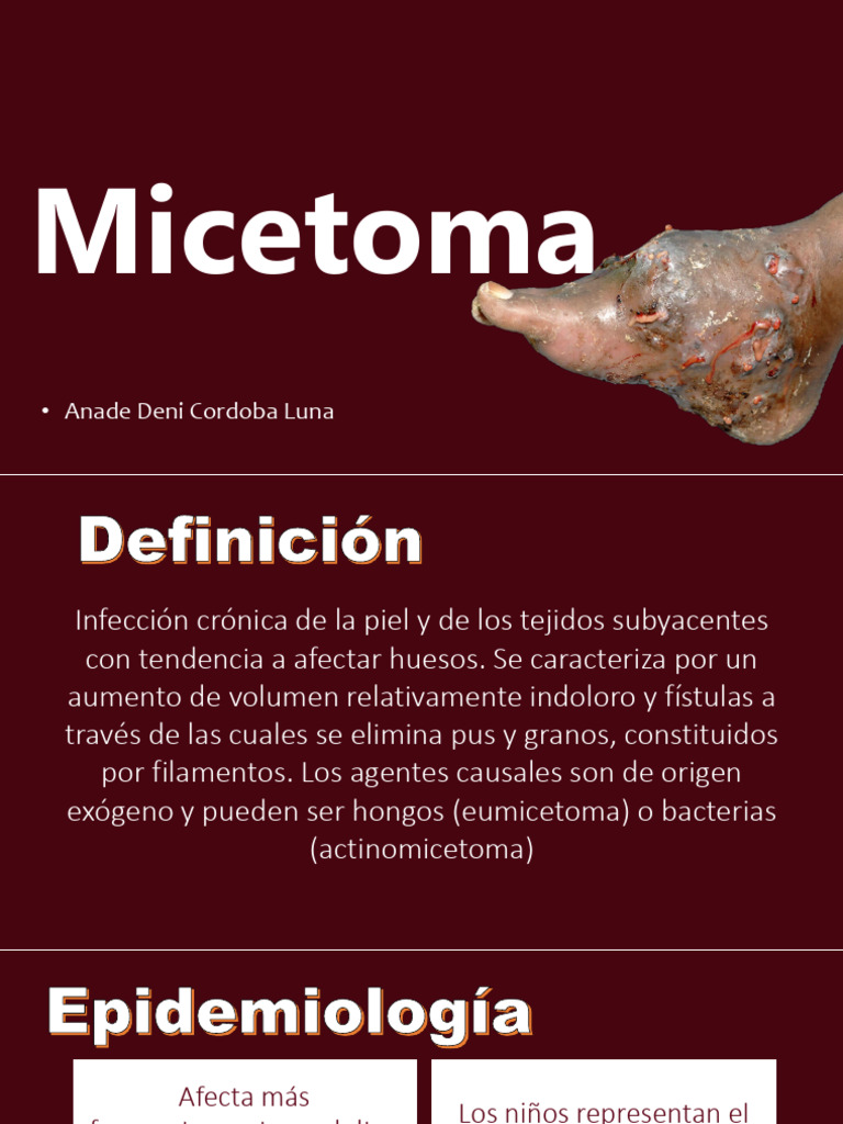 micetoma-230710015258-37322efd (1) | PDF | Enfermedades y trastornos