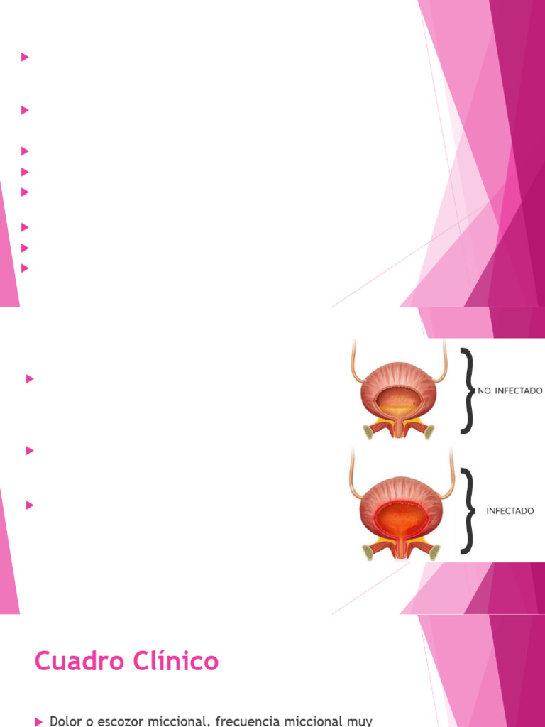 Cistitis Aguda | PDF