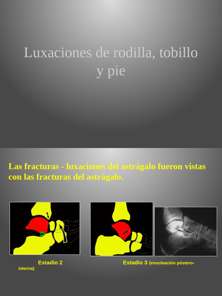 Luxaciones Rodilla Tobillo Pie | PDF | Tobillo | Rodilla