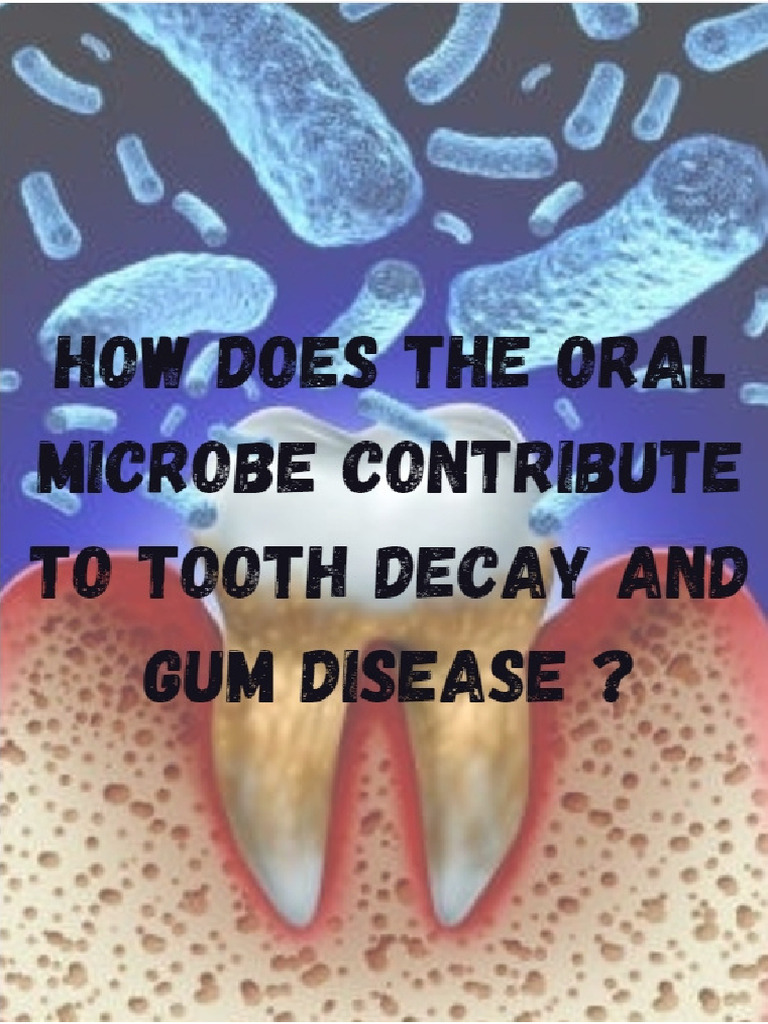 How Does Oral Microbes Contribute To Tooth Decay and Dental Health ...