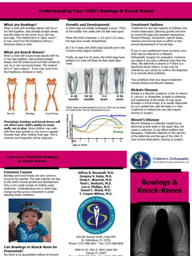 Understanding Bowlegs and Knock-Knees | PDF | Knee | Congenital Disorder