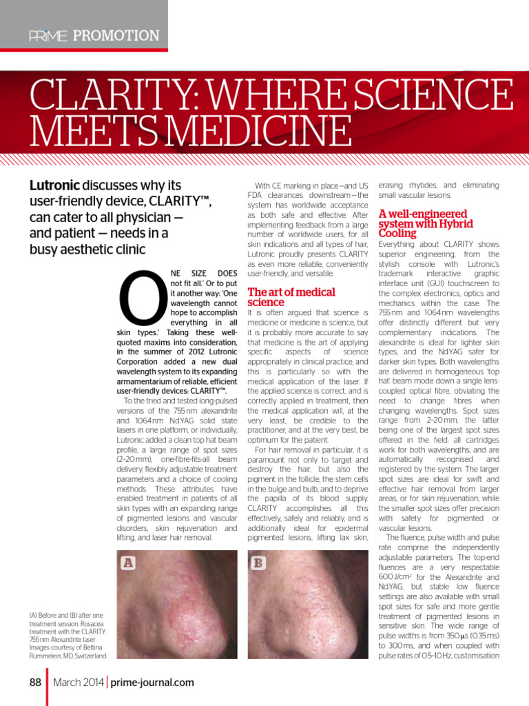 CLARITY PRIME Introduction 2014 | PDF