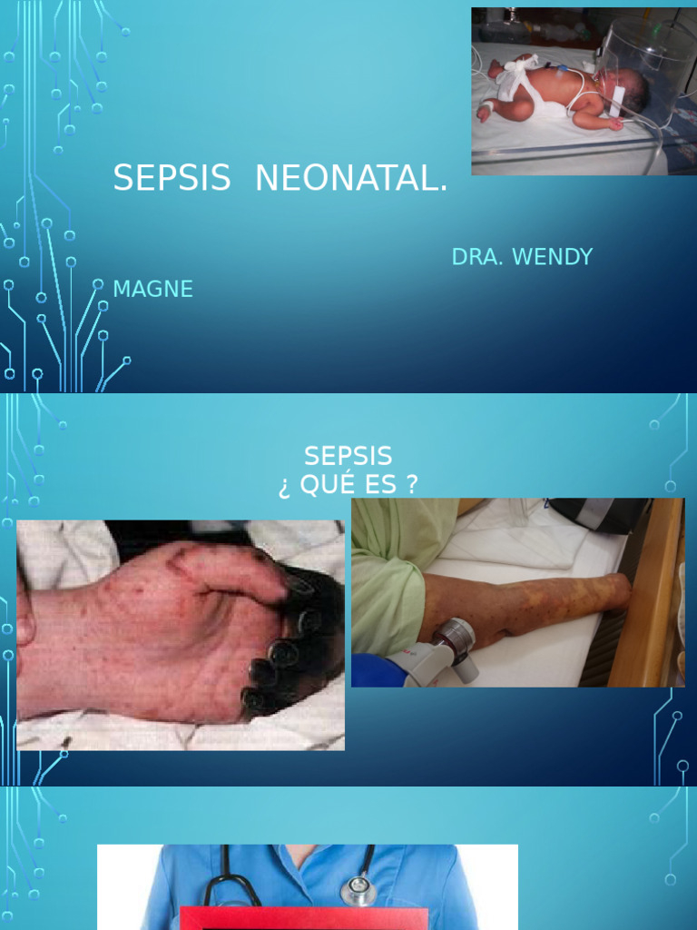 Sepsis Neonatal: Definición y Tratamiento | PDF
