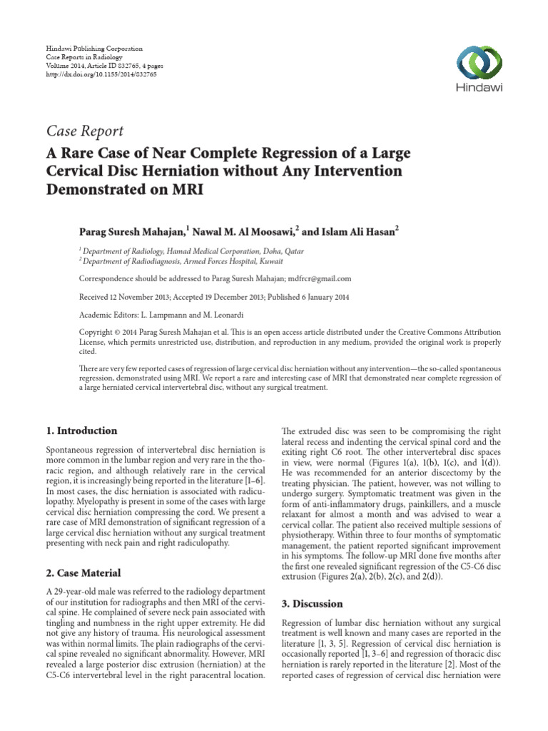 A Rare Case of Near Complete Regression of A Large Cervical Disc ...
