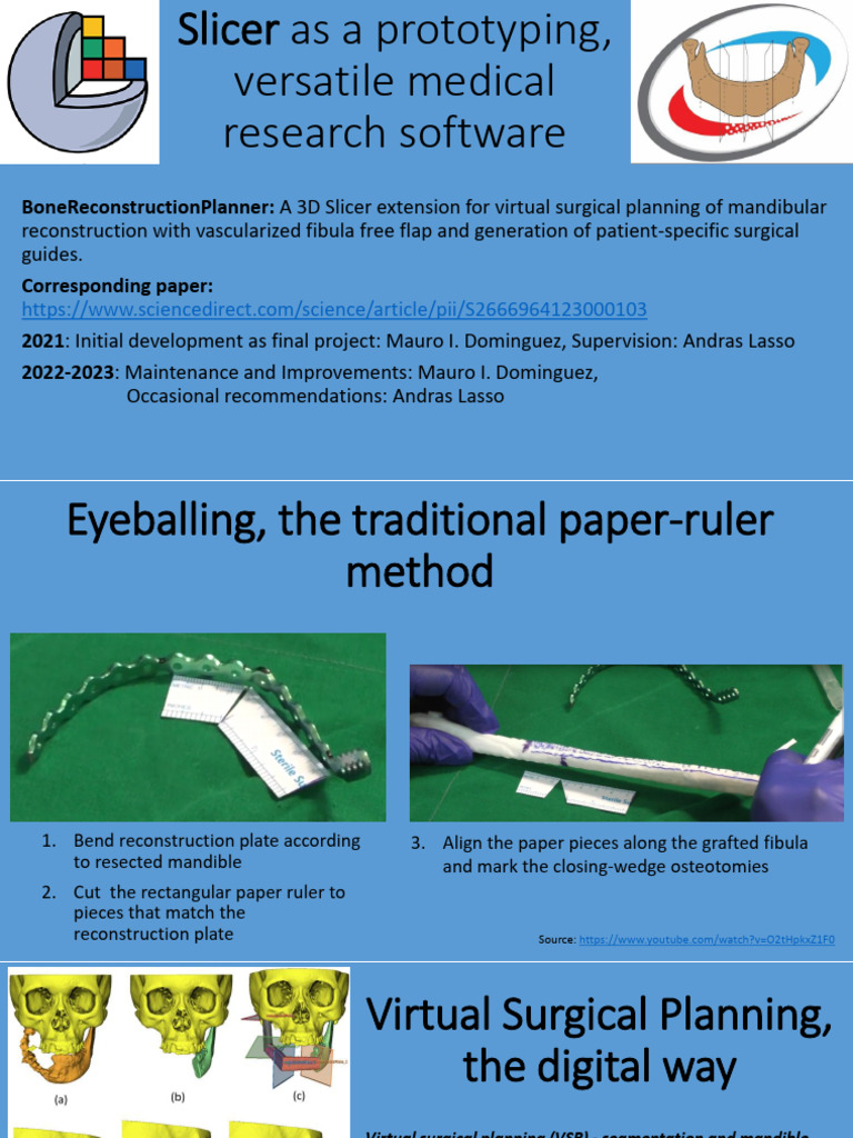 Bone Reconstruction Planning Software | PDF | 3 D Printing