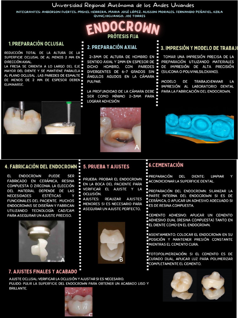 Endocrown Cartilla | PDF