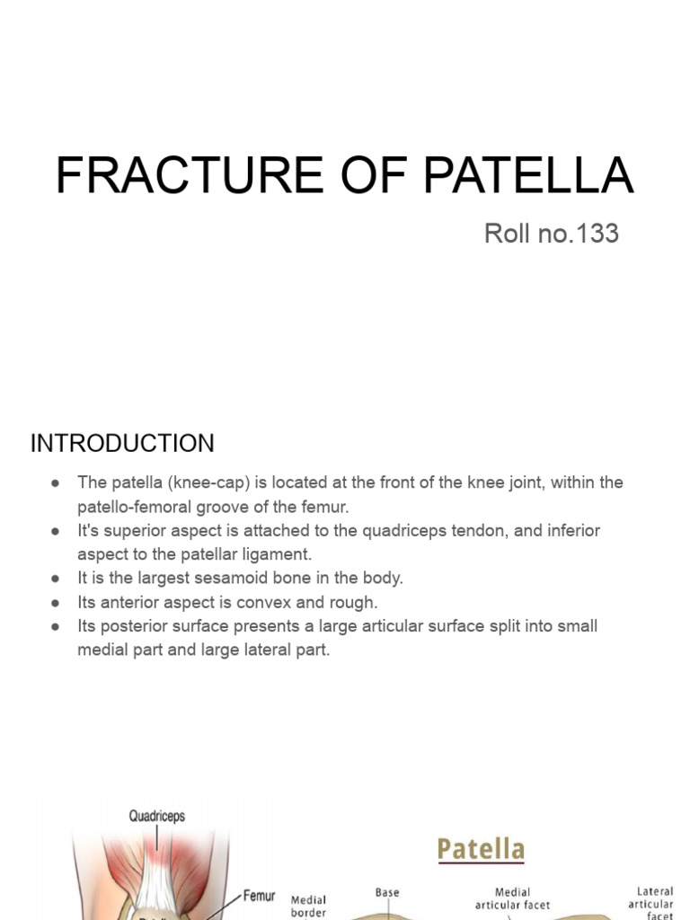 Patella fracture | PDF | Knee | Limbs (Anatomy)