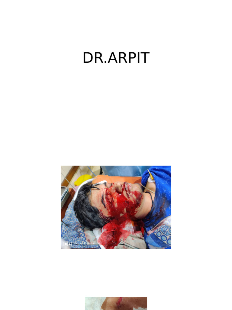 DR Arpit | PDF