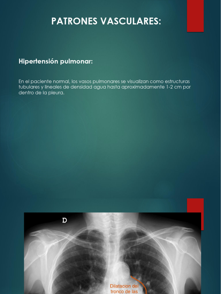 Radiografia de Torax Patologico Parte 3 (1) (Somente Leitura) | PDF ...