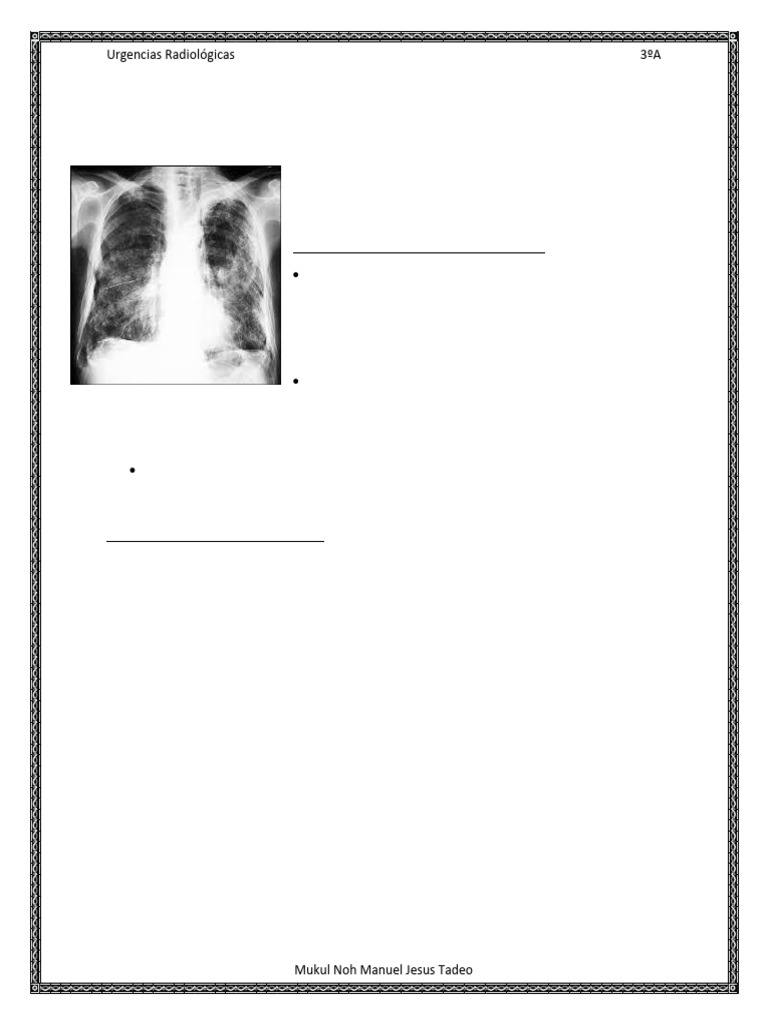 Pleuritis: Diagnóstico y Tratamiento | PDF | Enfermedades y trastornos ...