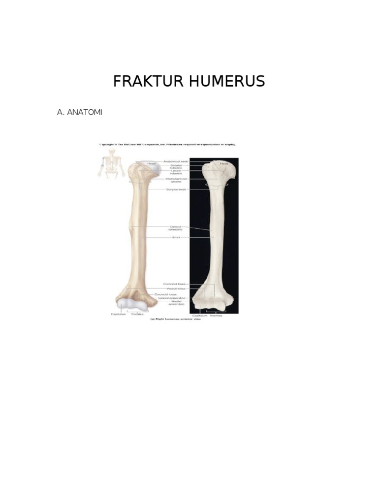 Fraktur Humerus | PDF