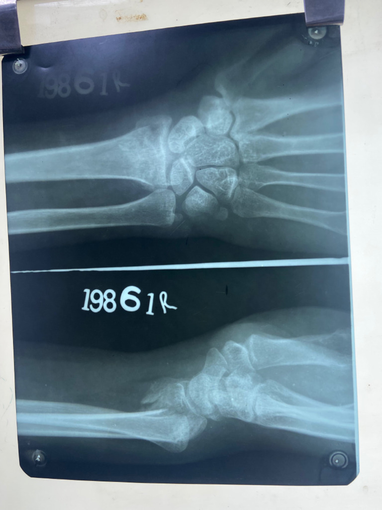 Ortho X Rays | PDF