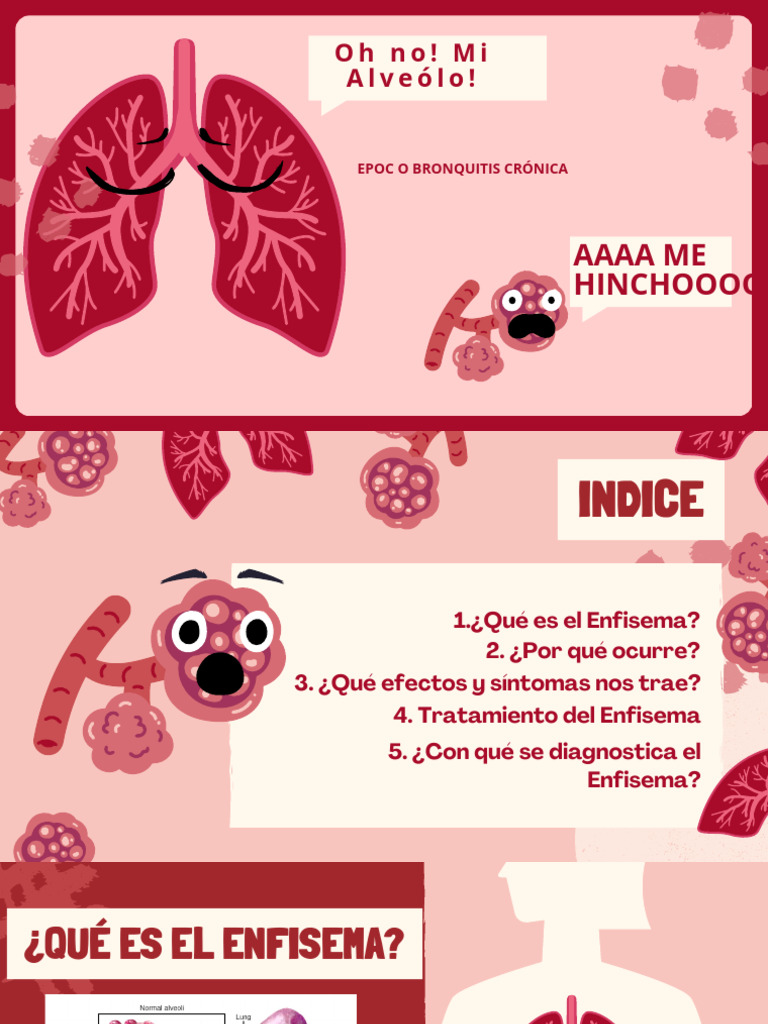 Enfisema y Bronquitis Crónica: Síntomas y Tratamientos | PDF