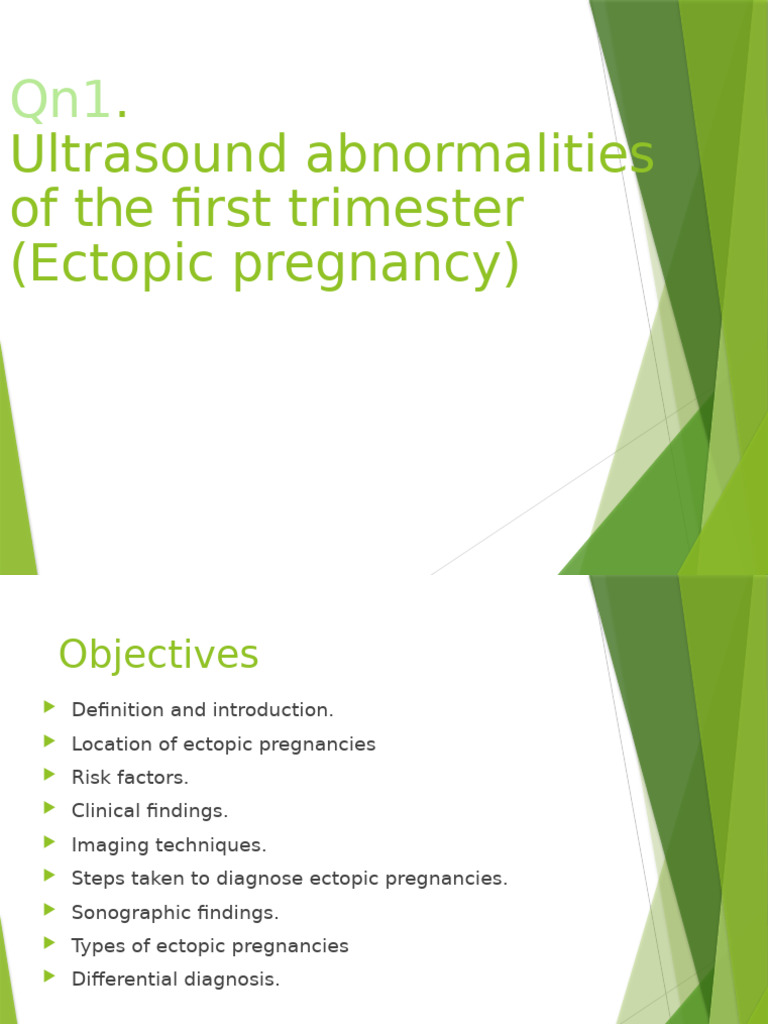 Group 3 Ectopic Pregnancy New (Final2) | PDF | Uterus | Pregnancy