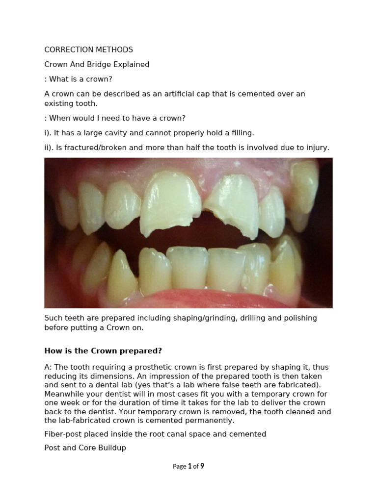1.1 Teeth Disorders Corrections | PDF | Orthodontics | Dentistry