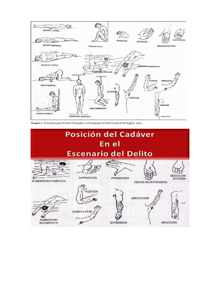 Posiciones Cadavericas | PDF