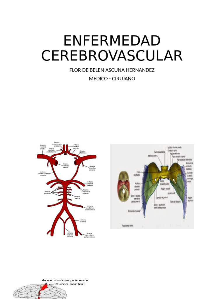 Enfermedad Cerebrovascular Fisiopatologia | PDF | Carrera | Isquemia