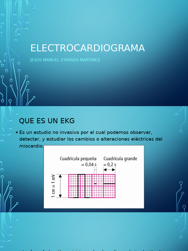 Guía Completa del Electrocardiograma EKG | PDF