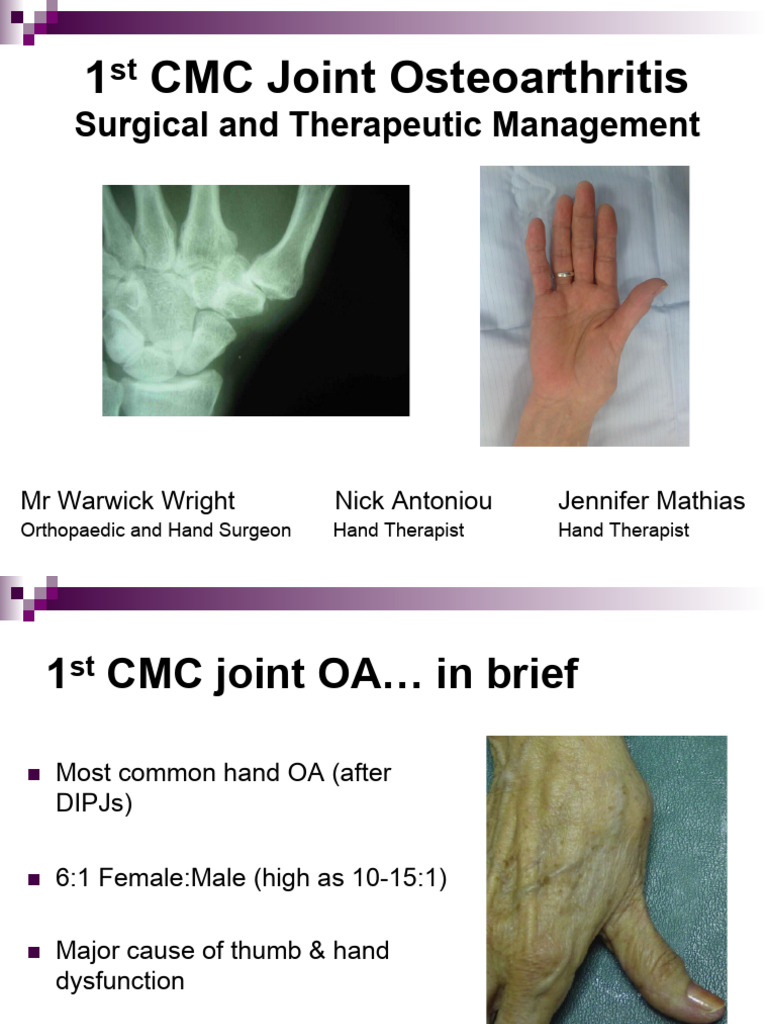 Melbourne Hand Therapy CMC Talk AHTA | PDF | Thumb | Musculoskeletal System