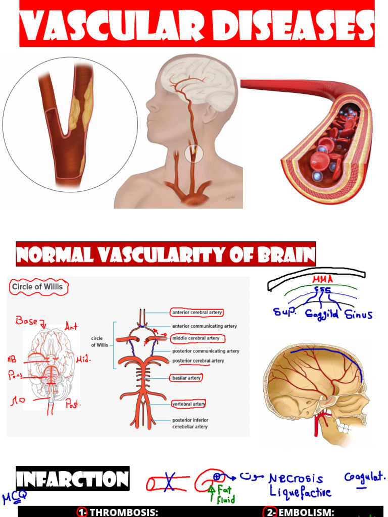 Vascular Diseases Copy Pdf