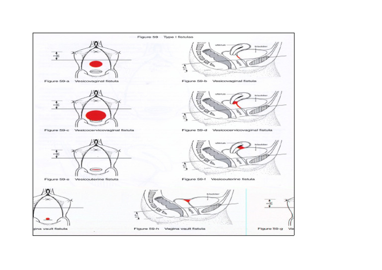 Vvf Pdf