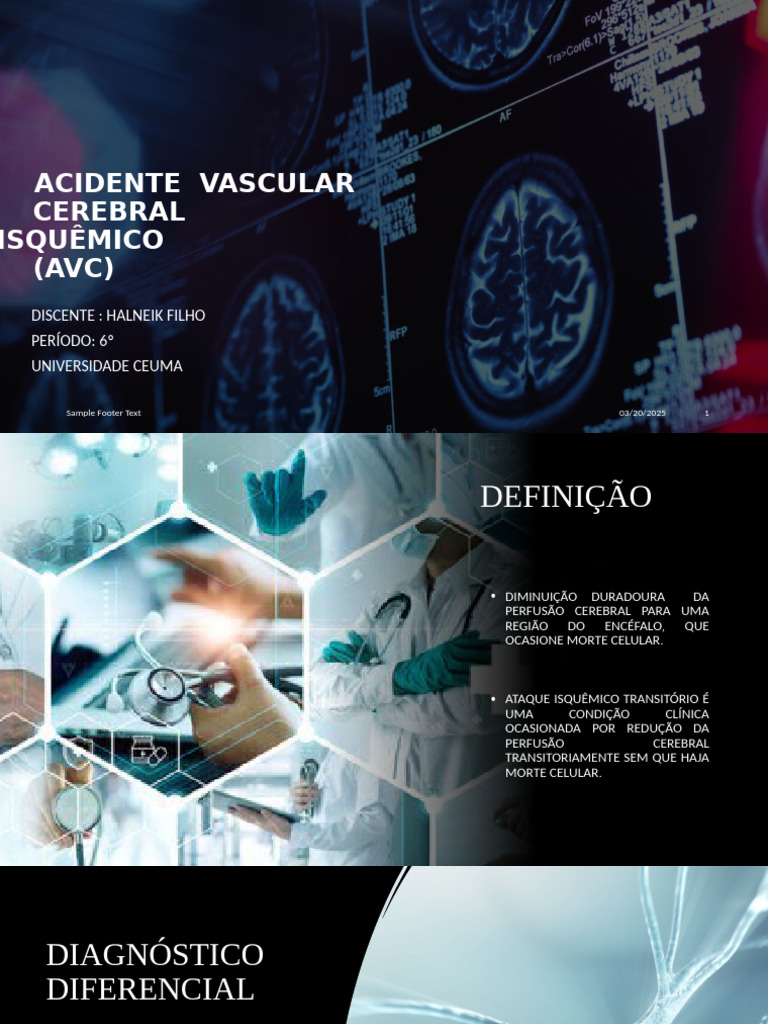 ACIDENTE VASCULAR ISQUÊMICO | PDF | AVC | Remédio