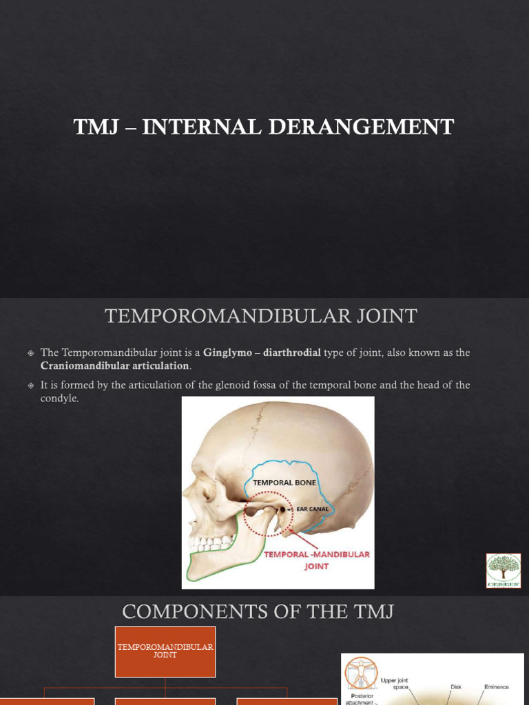 TMJ Internal Derangement Overview | PDF | Medical Specialties ...