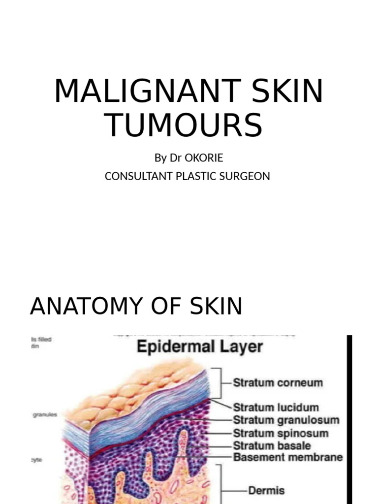 Malignant Skin Lesions | PDF | Metastasis | Melanoma