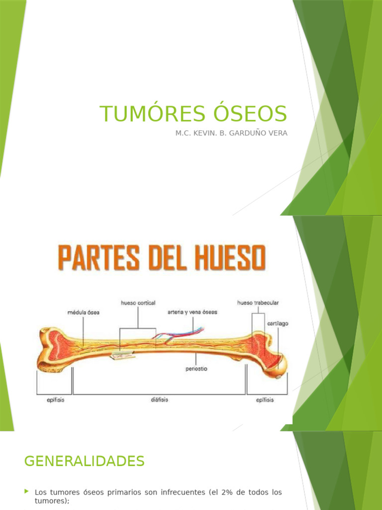 Tumóres Óseos | PDF | Hueso | Mieloma múltiple