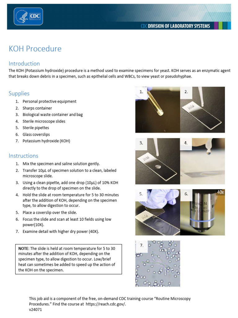 KOH-Procedure_508 | PDF