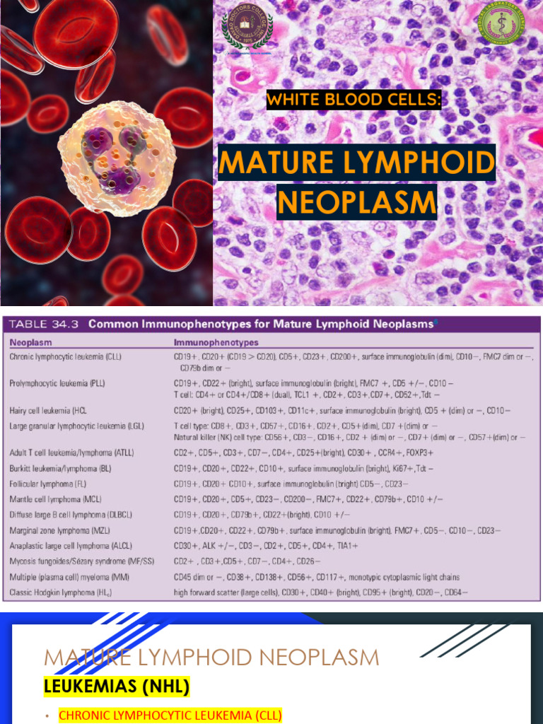Soccer Ball Appearance in CLL | PDF | Lymphoma | Lymphocyte