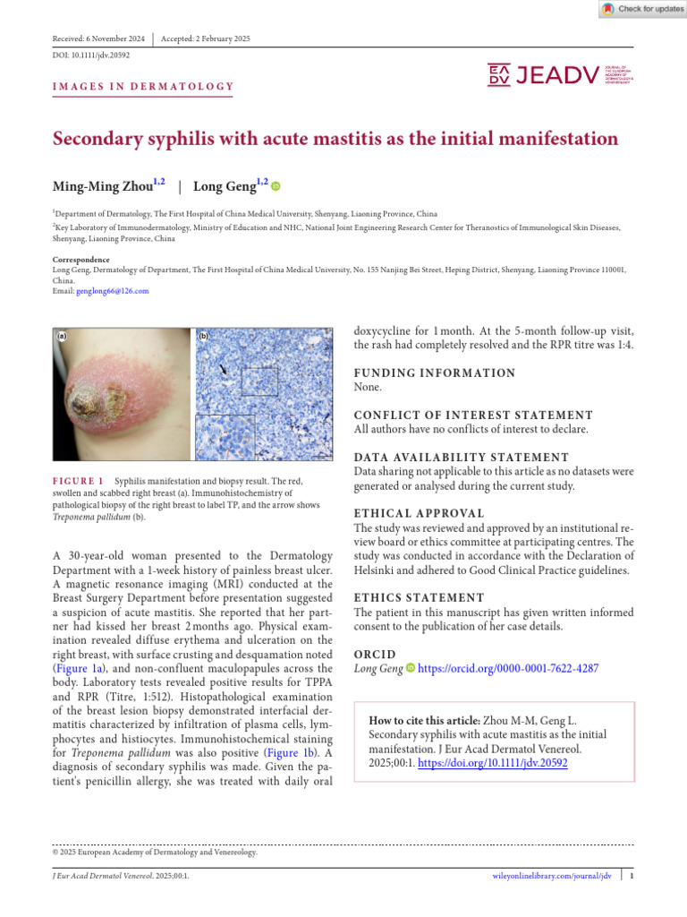 Acad Dermatol Venereol - 2025 - Zhou - Secondary Syphilis With Acute Mastitis As The Initial ...