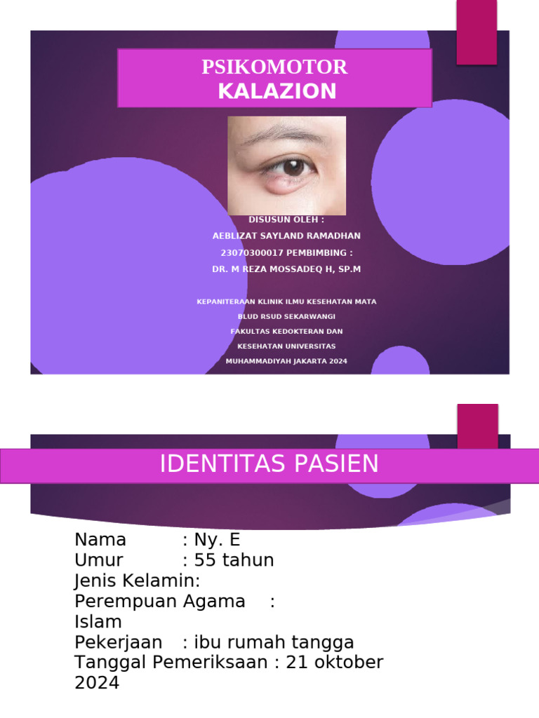 Penanganan Kalazion pada Pasien 55 Tahun | PDF
