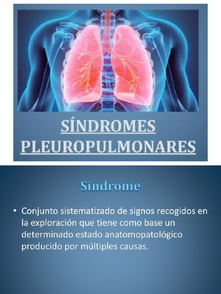 Criterios de Light para Derrames Pleural | PDF