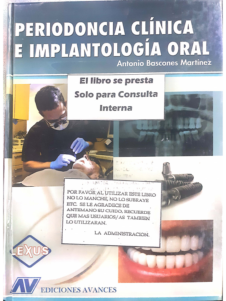 Capítulo 43 Periodontología Clínica e Implantologia Oral Antonio | PDF