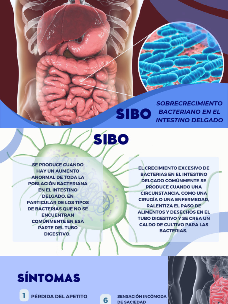 SIBO | PDF | Diarrea