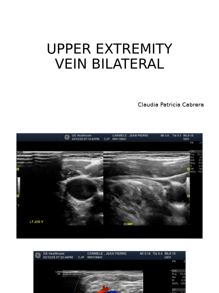 Upper Extremity Vein Bilateral | PDF