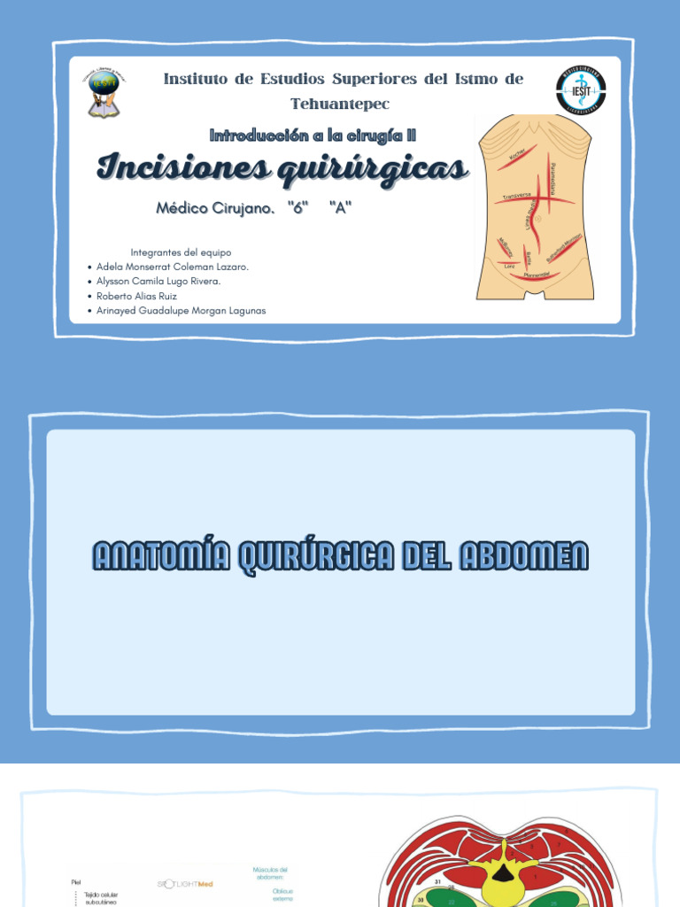 Tipos De Incisiones Abdominales Quirúrgicas Pdf Abdomen Anatomía