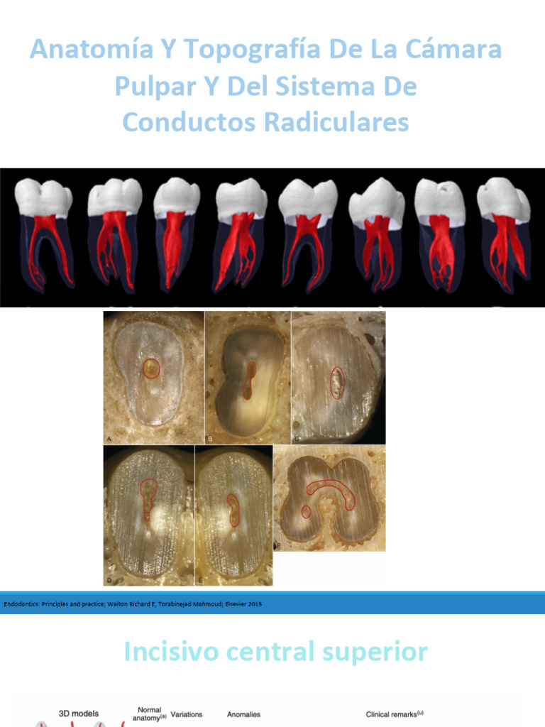Anatomía y Tratamiento de Conductos Radiculares | PDF | Ramas de ...