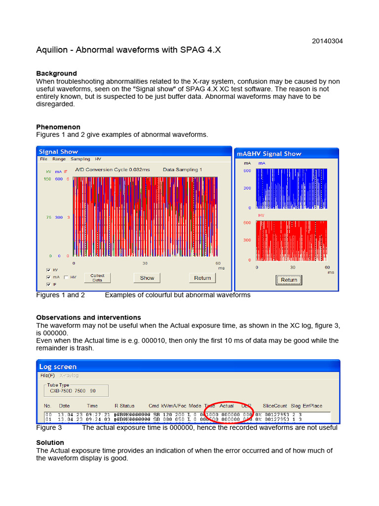 Aquilion - Abnormal Waveforms With SPAG 4X | PDF