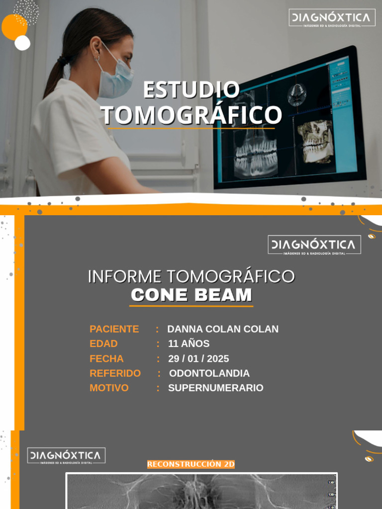 Estudio Tomografico Danna Colan Colan | PDF