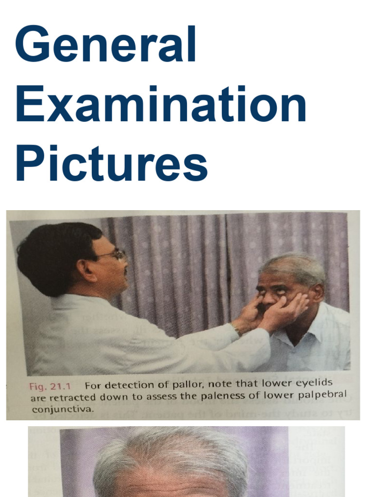 General Examination | PDF